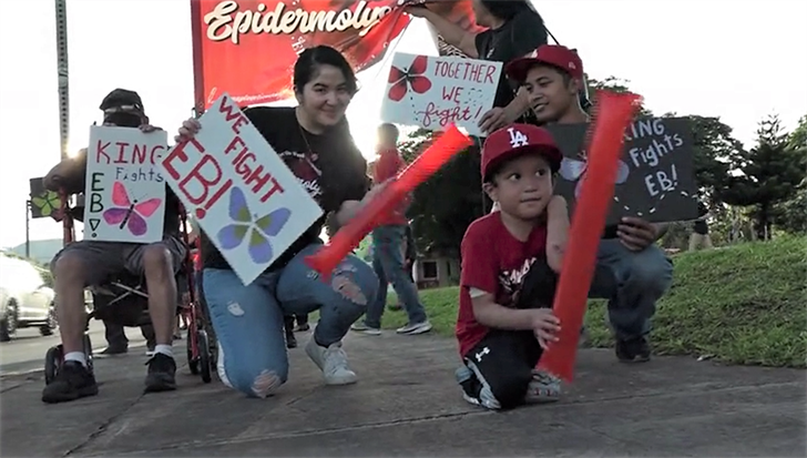 Wave caps off EB Awareness Week, fundraising continues for boy's skin ...