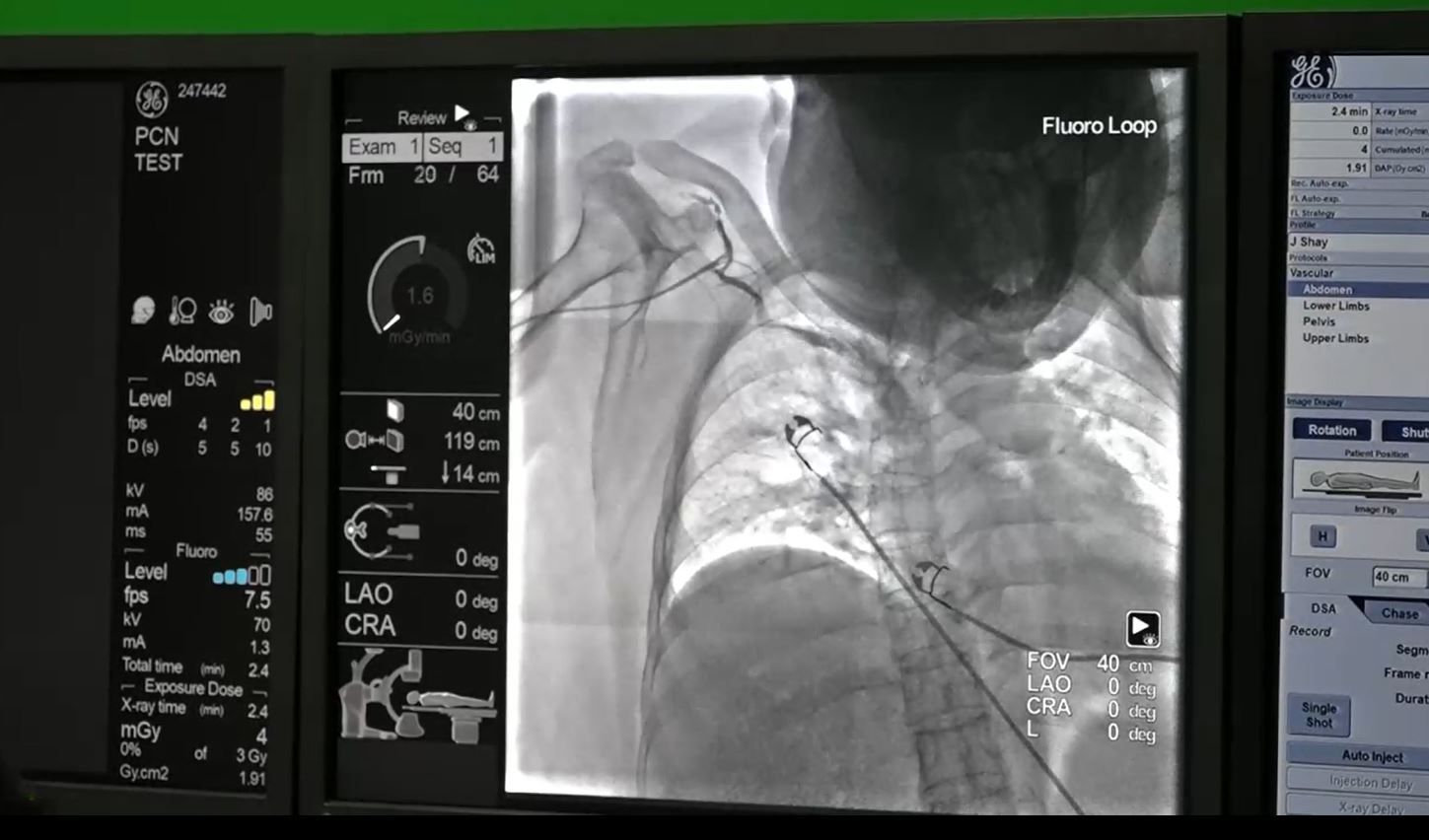 GMH's new angiosuite provides cutting edge technology, first in the ...